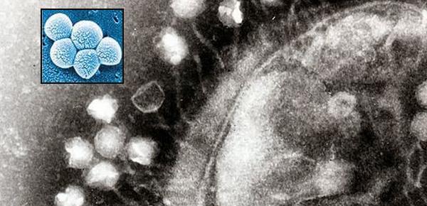 Wypuszczono groźne nanoboty « Wolne Media