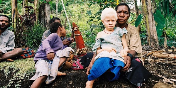 Dzieje papuaskich albinosów « Wolne Media